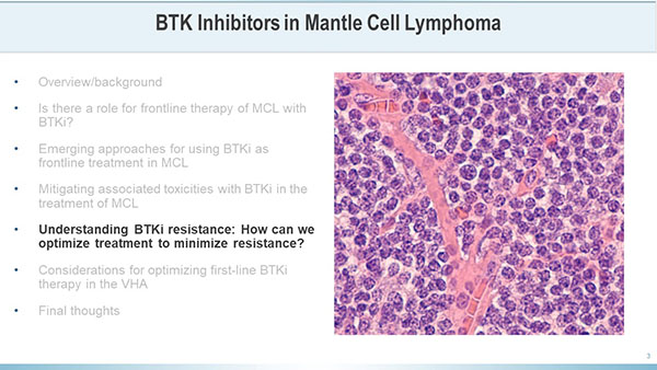 Front Line BTK Inhibitors in Mantle Cell Lymphoma | myCME