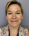 Pediatric Burn and Bruise Injuries | myCME