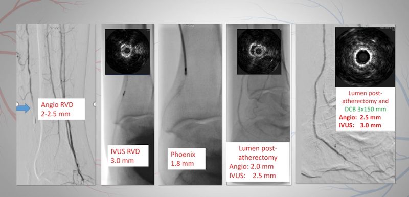 The PVD Channel | myCME