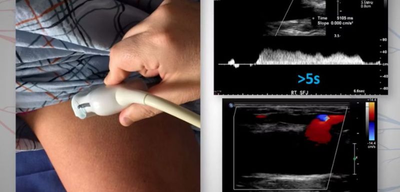 The PVD Channel | myCME