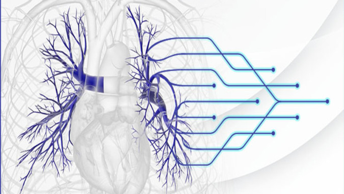Improve Diagnostic and Treatment Pathways for PAH | myCME
