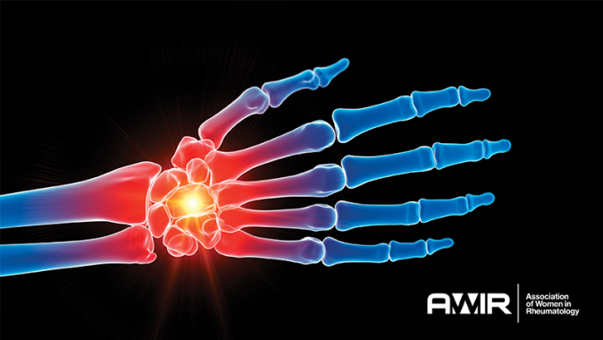 Nuts and Bolts of Rheumatology: Rheumatoid Arthritis | myCME