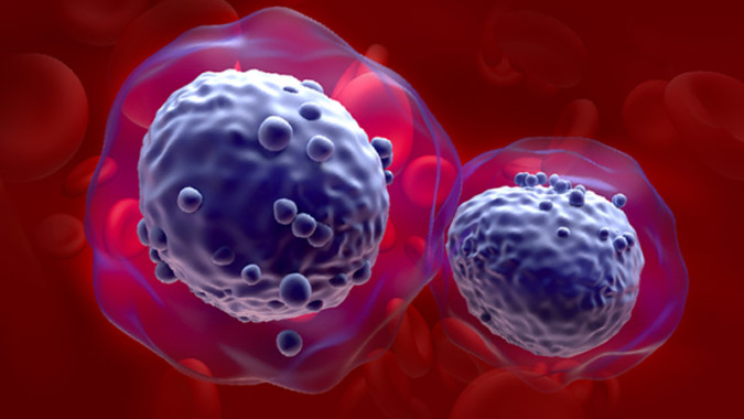 Navigating the Evolving Secondary AML Subtypes Landscape | myCME