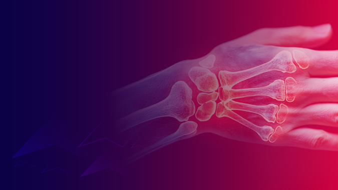 Current Guidelines for RA management | myCME