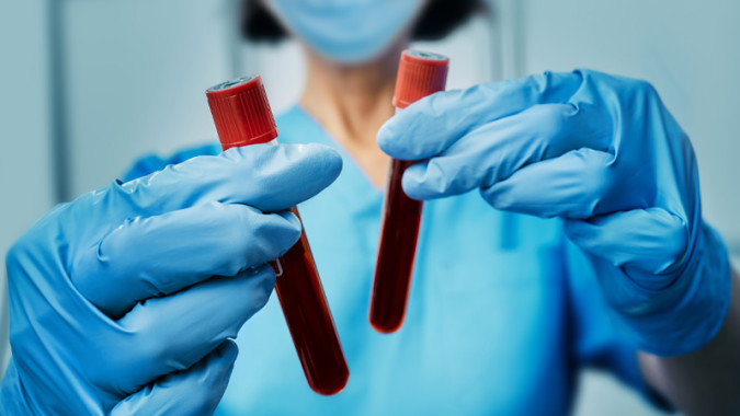 Treatment of Paroxysmal Nocturnal Hemoglobinuria | myCME