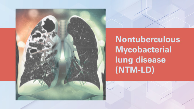 Can You Identify Patients with NTM? Diagnosis, Treatment & Monitoring