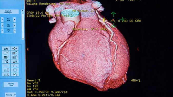 Noninvasive Cardiac Imaging: Enhancing Our Clinical Practice | myCME