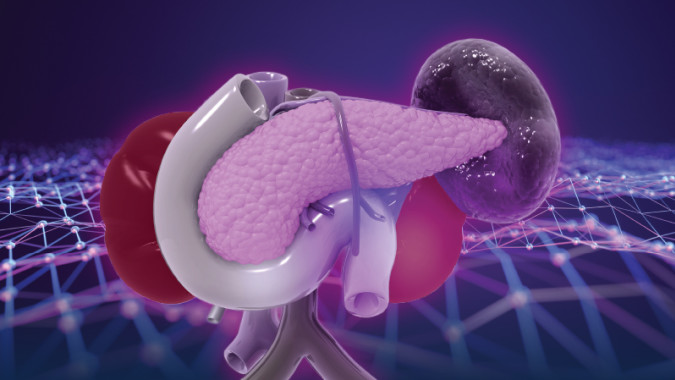 Type 2 Diabetes and Chronic Kidney Disease | myCME