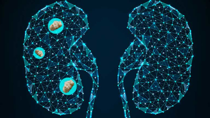 Management of Patients with PH1: A Case Study | myCME