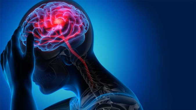 Diagnosis, Treatment and Prevention Therapies in Primary Headache ...