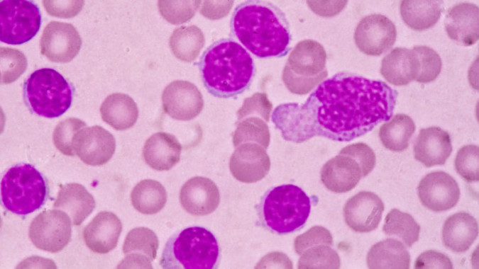 Emerging Treatments for CLL and MCL | myCME