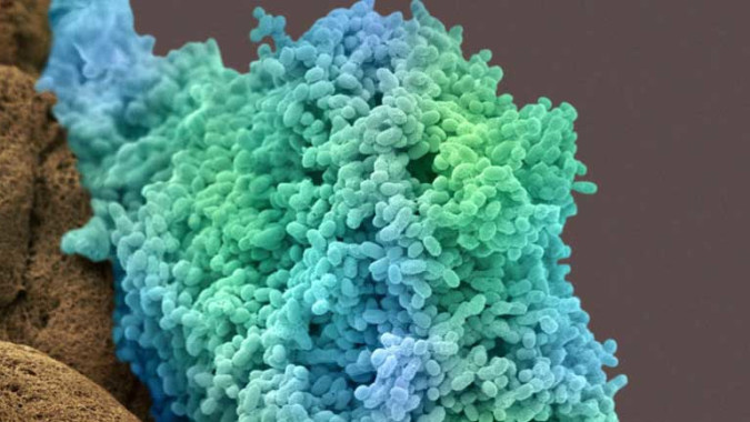 Necrotizing Enterocolitis: Treatment and Prevention