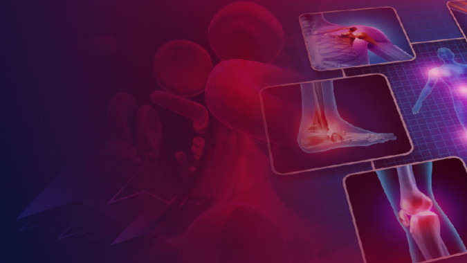 Individualizing Care in Hemophilia A to Optimize Joint Health | myCME