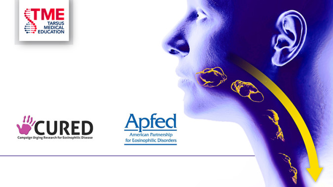 Advances in Managing Eosinophilic Esophagitis | myCME Advances in Managing Eosinophilic Esophagitis | myCME