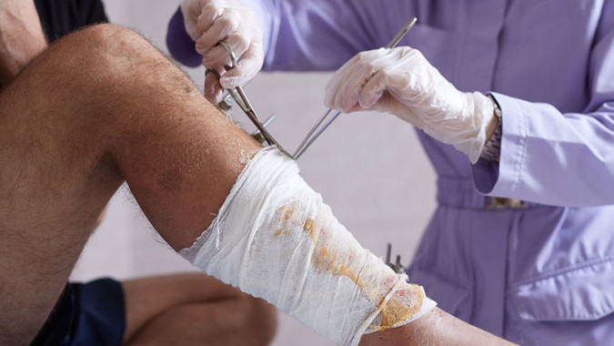 Wound Care and Infection Prevention | myCME