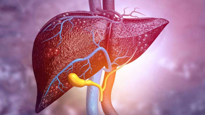 A Deeper Dive into NASH Diagnosis and Treatment | myCME