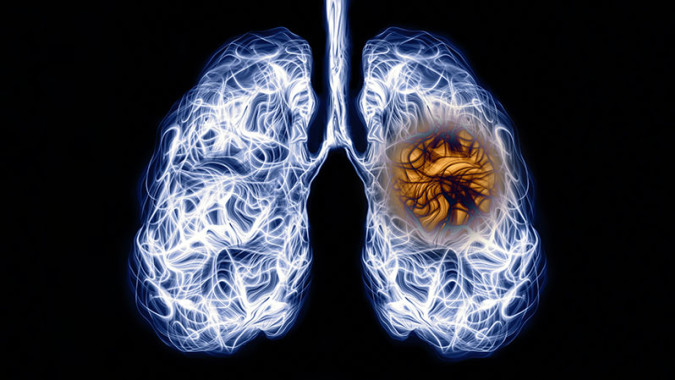 Case-based learning for NTM/MAC | myCME