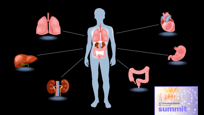 Optimizing Immunotherapy: Managing Adverse Events | myCME Optimizing Immunotherapy: Managing Adverse Events | myCME