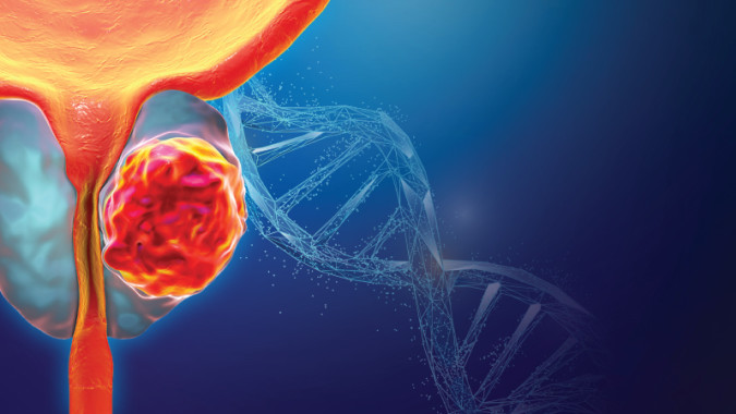 Examining the Clinical Potential of PARP Inhibitors in Prostate Cancer