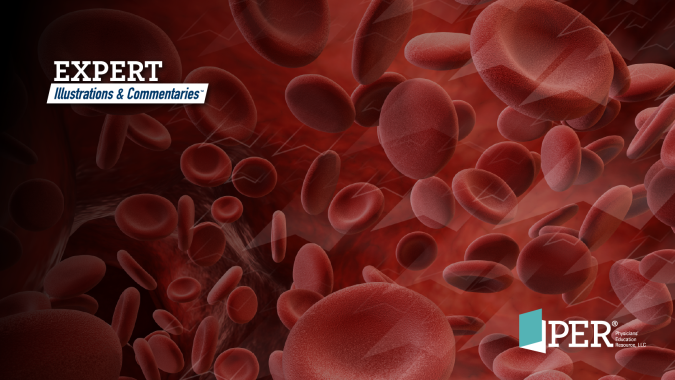 Treatments to Improve Care for Patients with Anemia in CKD | myCME