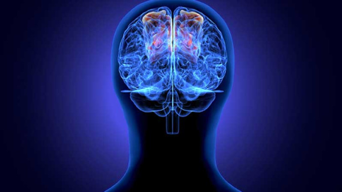 Prevention and Treatment of Cerebral Edema in Large Hemispheric ...