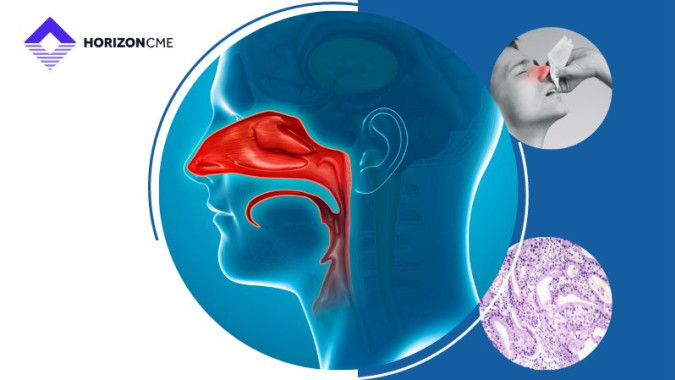 Innovative Approaches to Managing CRSwNP | myCME