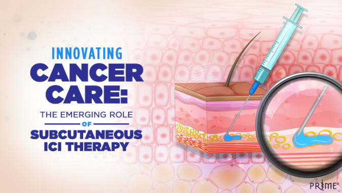 Innovating Cancer Care: The Emerging Role of Subcutaneous ICI Therapy
