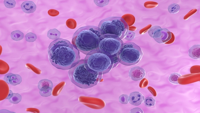 Perspectives for High-Risk and Relapsed/Refractory AML | myCME