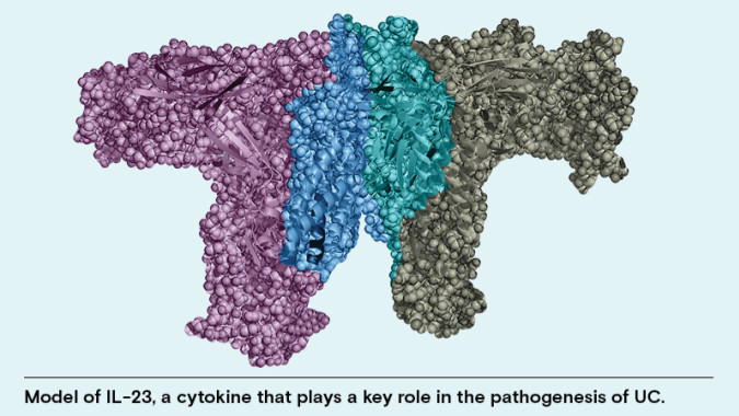 A Surge of Treatment Options in Ulcerative Colitis | myCME