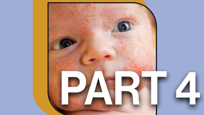 The Changing Landscape of Atopic Dermatitis: Long-term Treatment for ...