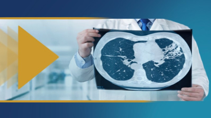 Strategies for Mycobacterium Avium Complex Infections | myCME