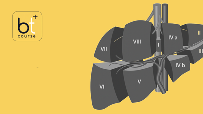 Y-90 Dosing and Ablation Modalities for HCC | myCME