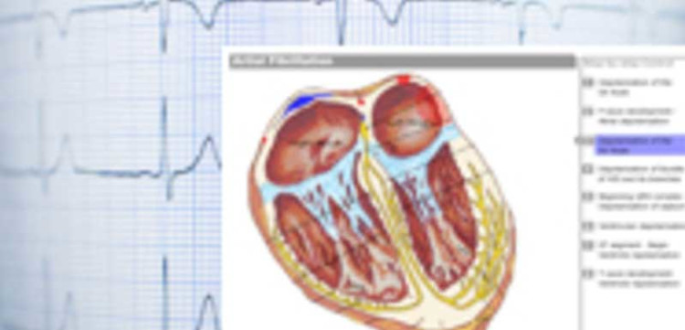 Online ECG Courses | myCME