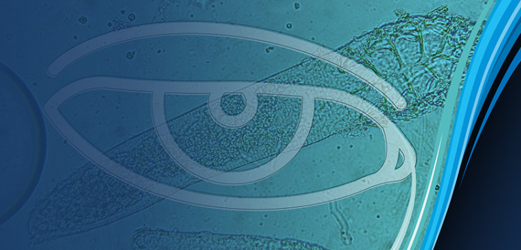 Eye Disorders CME - Free Eye Disorders Courses Online | myCME