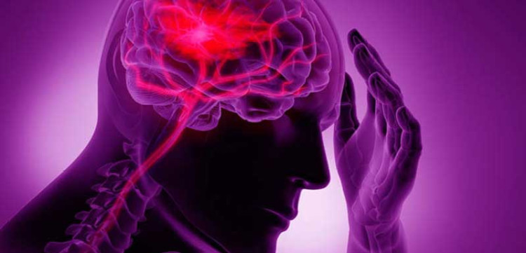 Maximizing Patient Outcomes in Posterior Circulation Stroke: Accurate ...