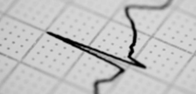 Online ECG Courses - Free Medical Education Credits | myCME