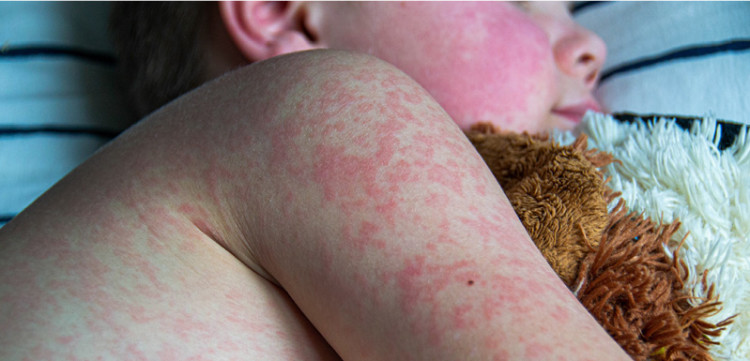 Free CME Courses for Physicians | Free Online CME | myCME