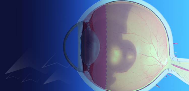 Ophthalmology CME - Free Ophthalmology Courses Online | myCME