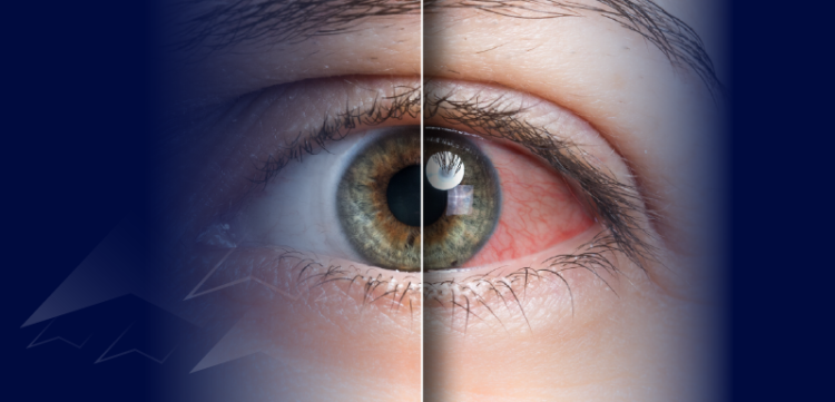 Ophthalmology CME - Free Ophthalmology Courses Online | myCME