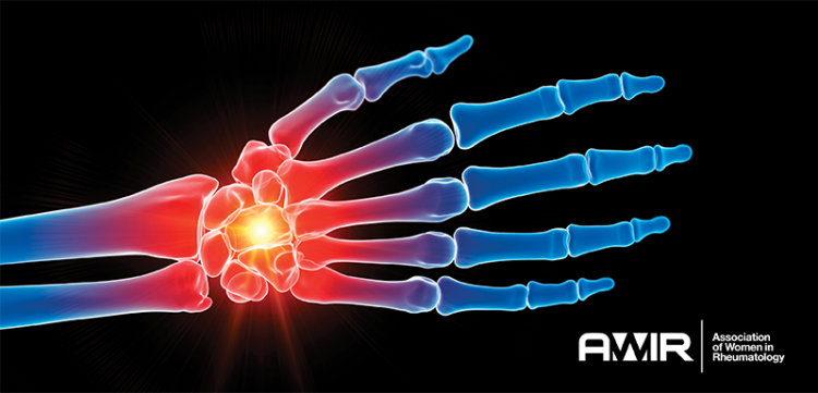 Rheumatoid Arthritis CME - Free Online CME | myCME