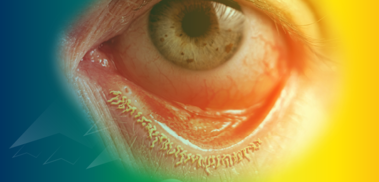 Ophthalmology CME - Free Ophthalmology Courses Online | myCME