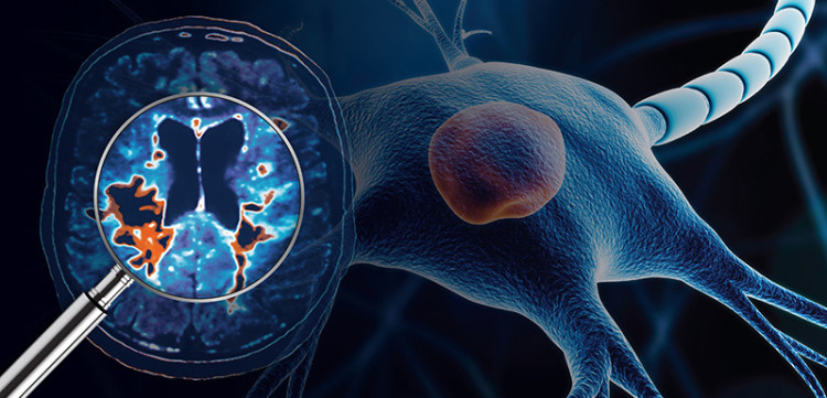 Neurology CME - Free Neurology Courses Online | myCME