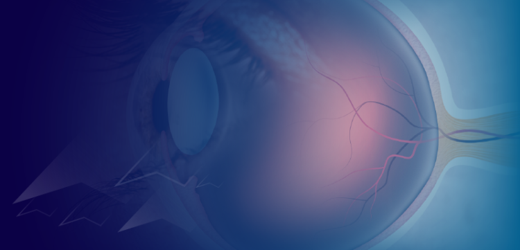 Ophthalmology CME - Free Ophthalmology Courses Online | myCME