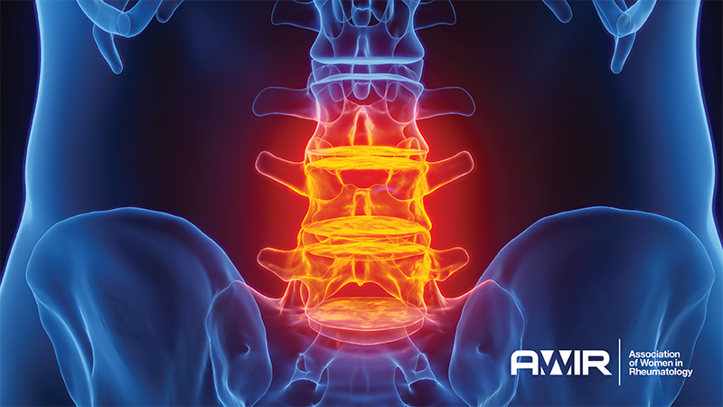 Rheumatology CME/CE Courses - Rheumatology Advisor