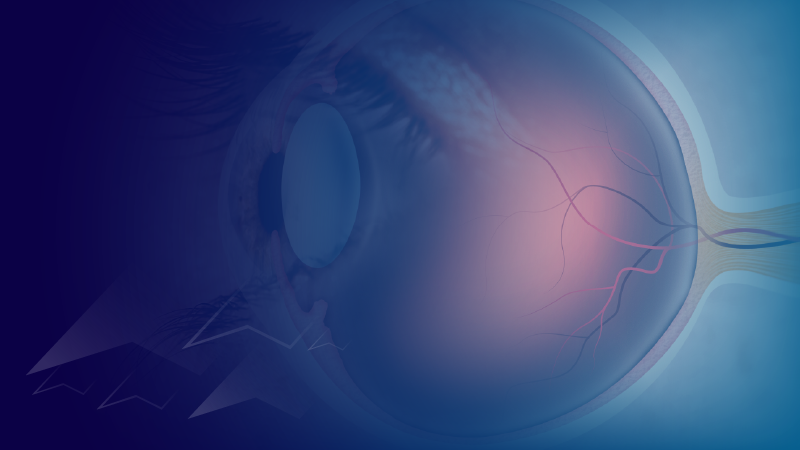 Ophthalmology CME/CE Courses - Ophthalmology Advisor