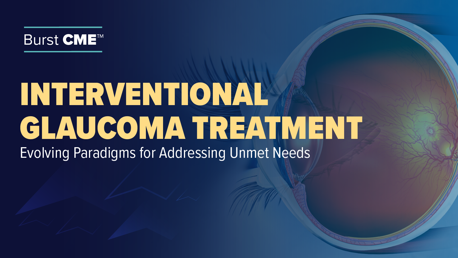Burst CME™ Part 2: Interventional Glaucoma Treatment: Evolving ...