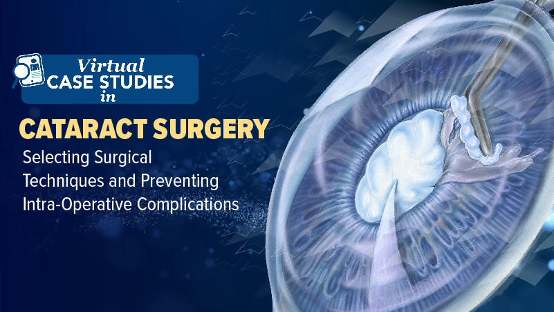 Virtual Case Studies™ in Cataract Surgery: Selecting Surgical ...
