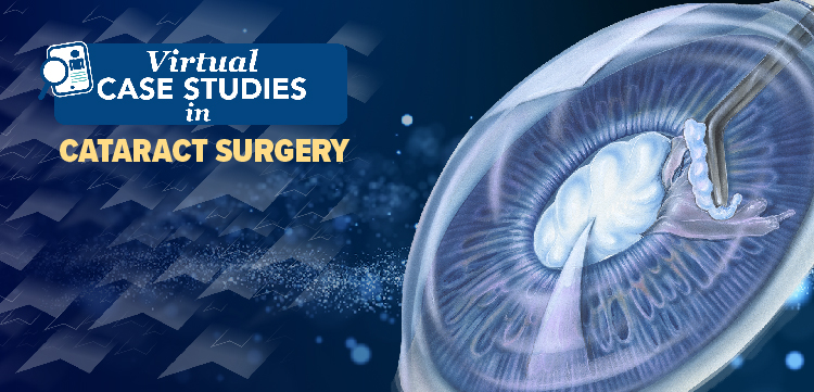 Virtual Case Studies™ in Cataract Surgery: Selecting Surgical ...